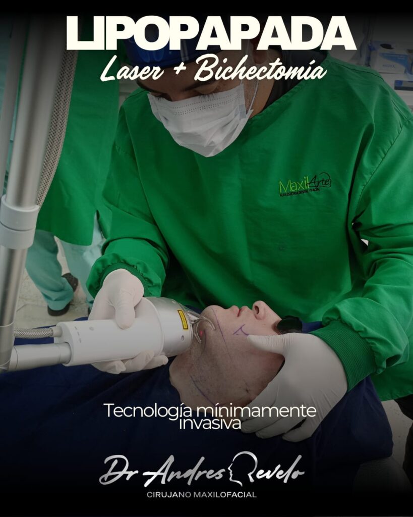 Liposucción de Papada Láser en Cali: Transforma Tu Perfil Facial